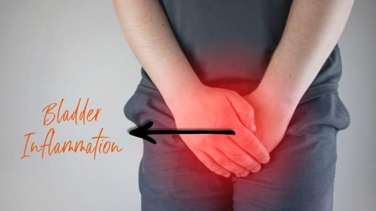 Bladder Inflammation: Comprehensive Guide with ANF Therapy®️