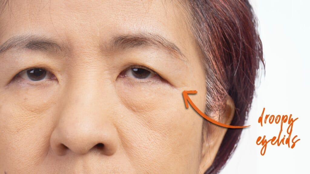 How to treat Facial Nerve palsy (Bell’s Palsy)? – ANF Academy